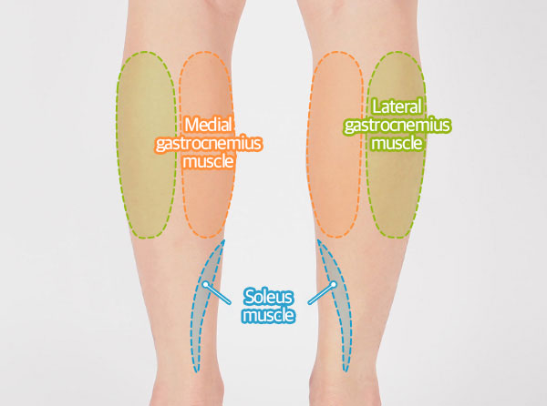 Calf Reduction Surgery - Lamiche Plastic Surgery